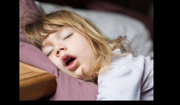 Ini Masalah yang Bisa Terjadi Jika Anak Suka Tidur dengan Mulut Terbuka