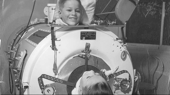 Penyintas Polio yang Habiskan 70 Tahun Hidupnya dalam "Paru-Paru Besi ...