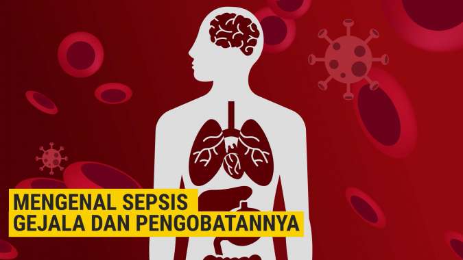 Mengenal Sepsis: Gejala, Penyebab Hingga Cara Penangannya