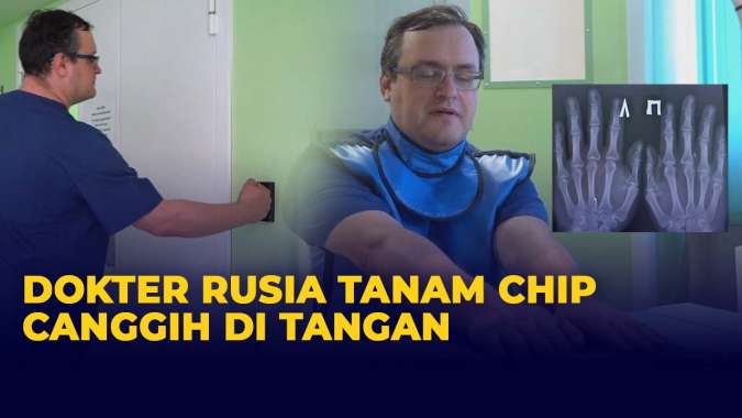 Membuat Hidup Lebih Mudah, Seorang Dokter Menanam Chip Canggih di Tangannya