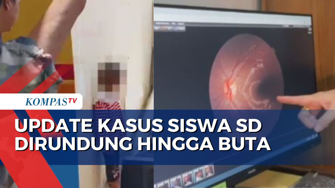 Video: Hasil MRI Siswa SD Dirundung hingga Buta: Pengelihatan Turun 80 ...