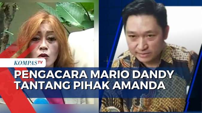 Amanda Laporkan Pencemaran Nama Baik, Kuasa Hukum Mario: Buktikan, Akan Ada Konsekuensinya